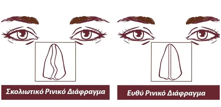 Καλύτερος ΩΡΛ Χειρουργος για Διάφραγμα Μύτης – Top 5 (2026)